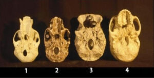 Les caractéristiques physiques de la bipédie et de la position ...