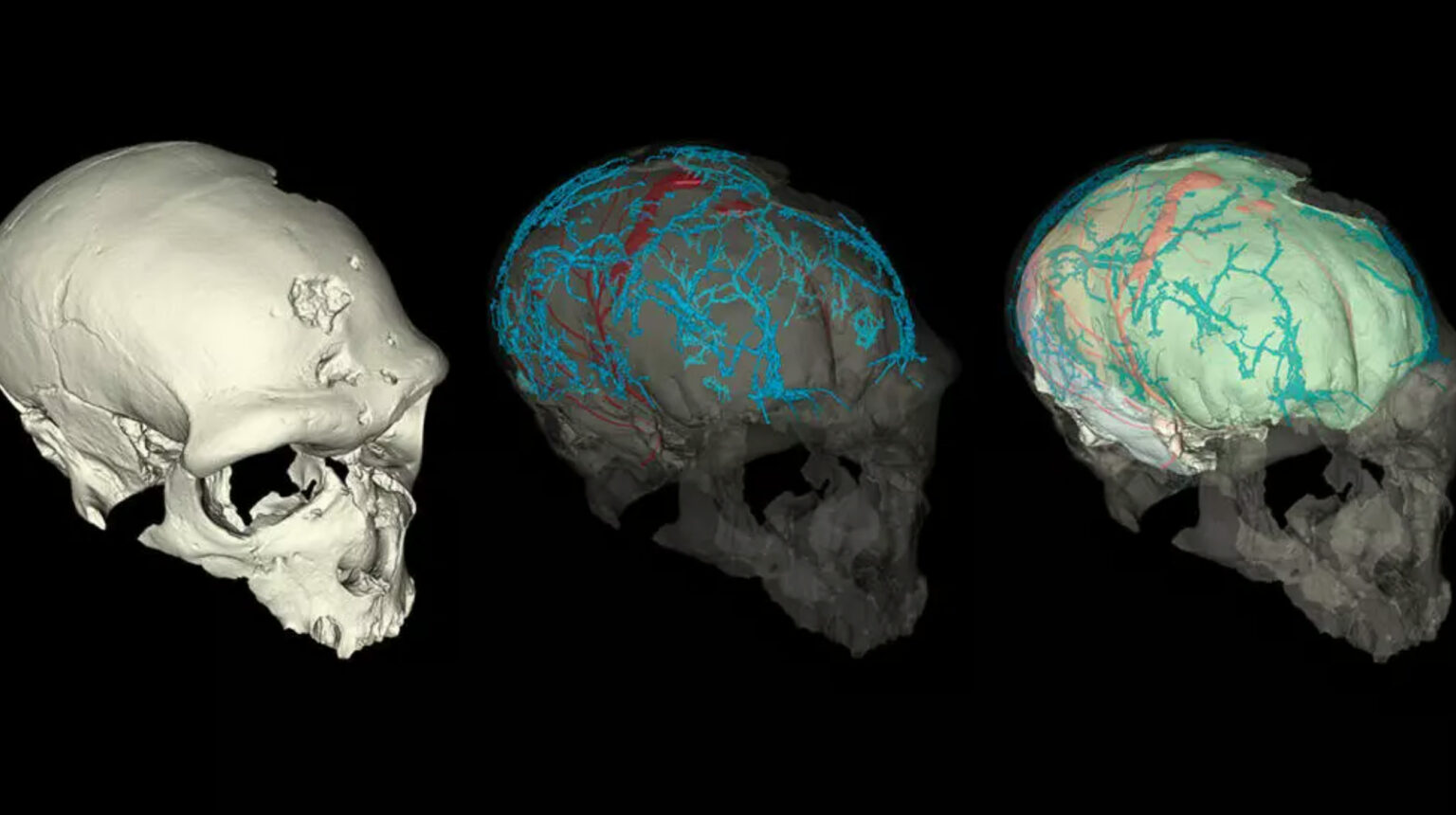Les hominoïdes, des premiers primates au dernier ancêtre commun - Hominides
